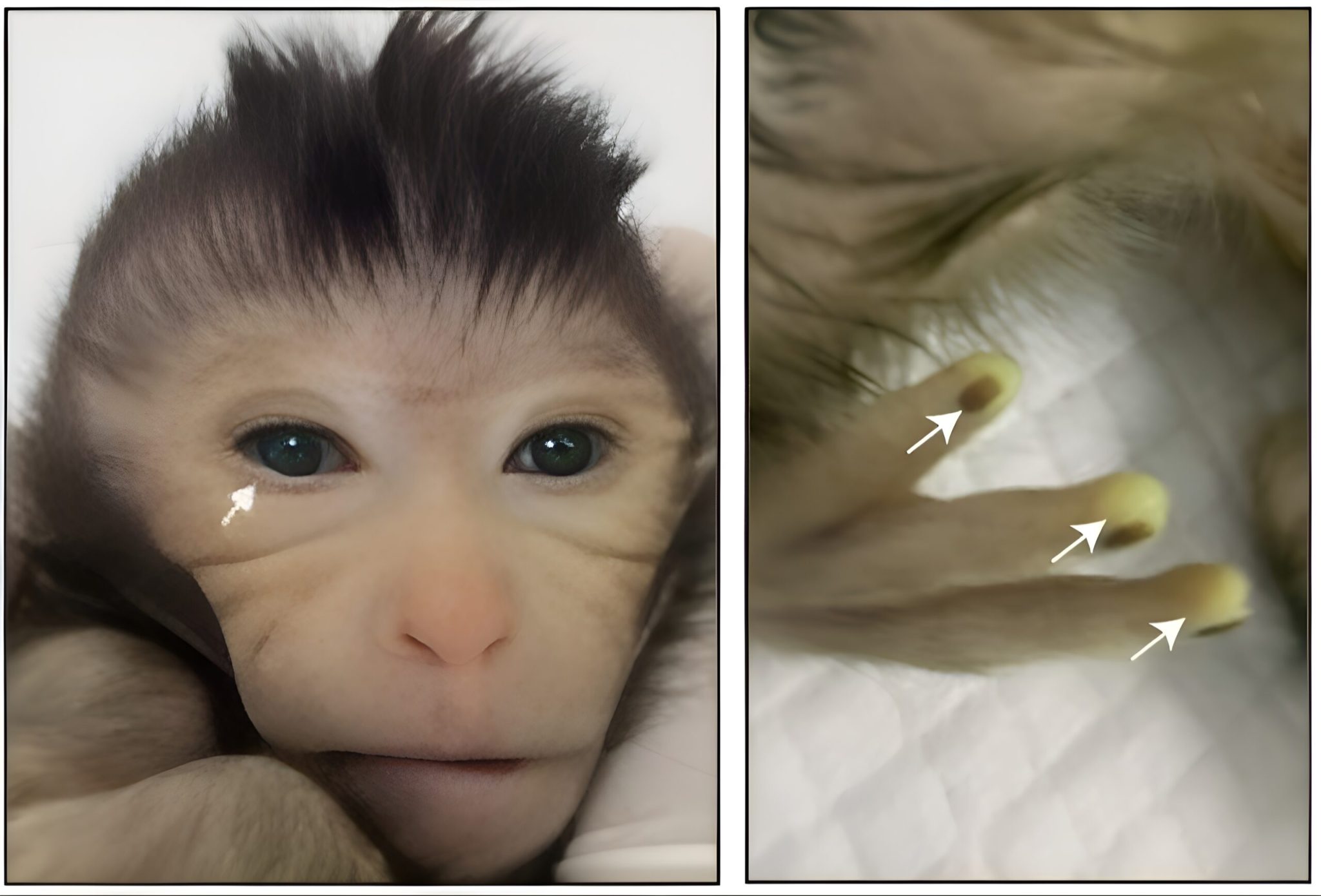 Inédito no mundo: nascimento vivo de um macaco quimérico criado com ...